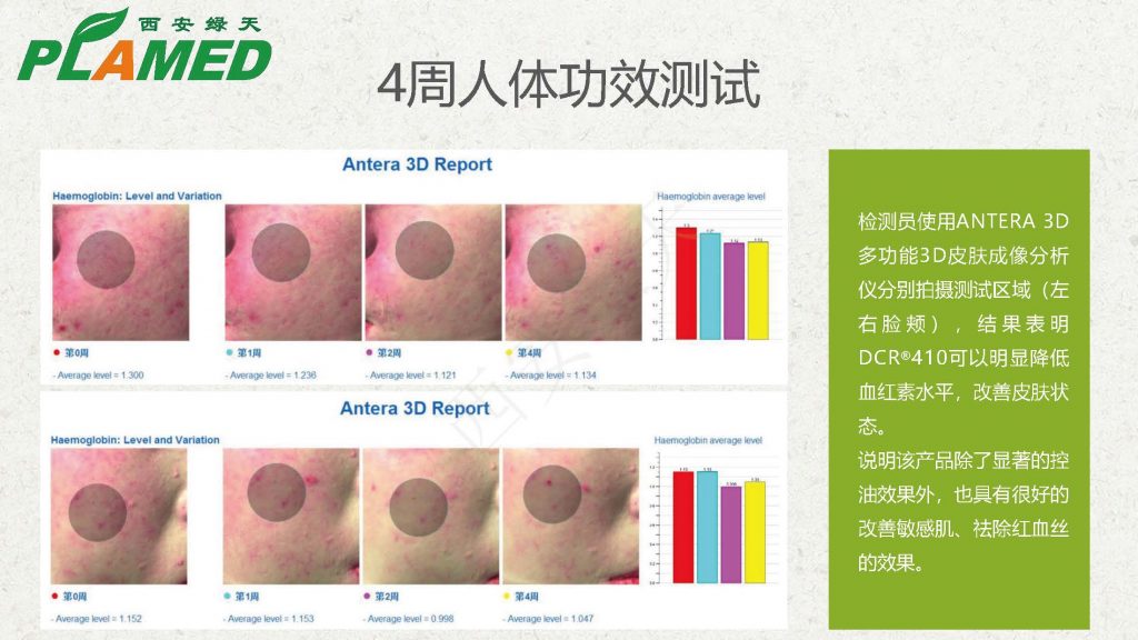 DCR®410-强控油舒缓天然因子-油敏肌专用